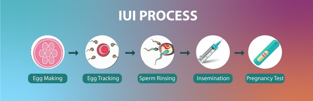 10 Best IUI Centres in Delhi: IUI Cost, Procedure, and Success Rate ...
