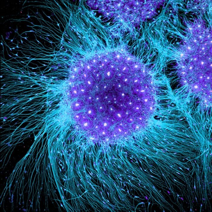 Stem Cells: What Is It and What does It | Aurawomen