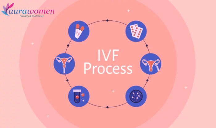IVF Process – Step-by-Step Guide to IVF Procedure 2024 | Aurawomen